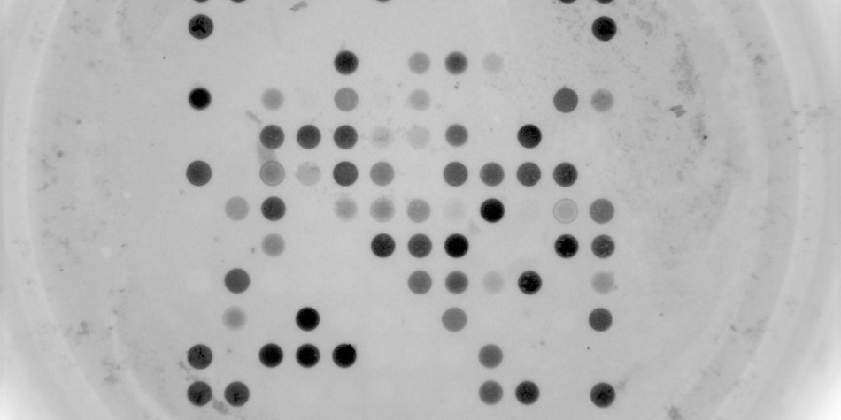 Example of Microarray of Antigenes on a 96-well MTP Bottom - M2-Automation